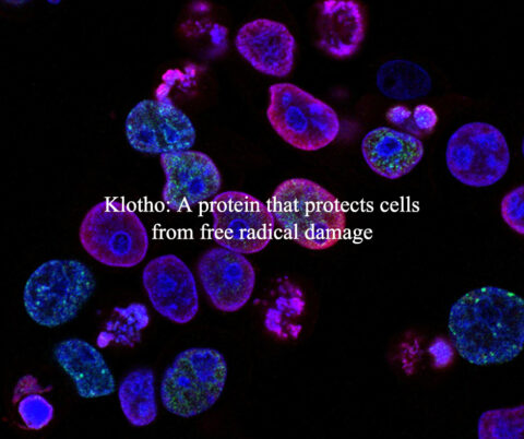 Klotho: A protein that protects cells from free radical damage | BodStim